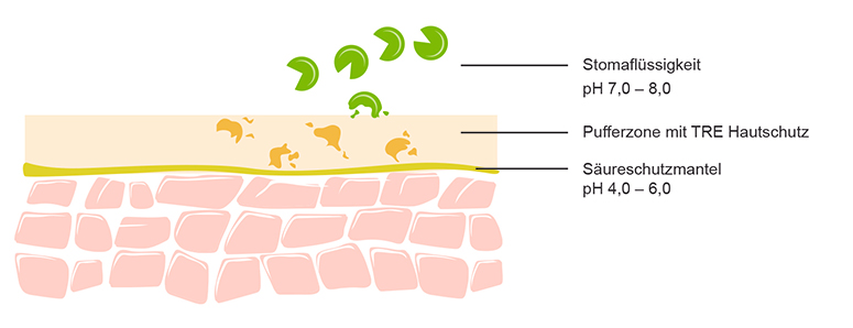 Dansac TRE Technologie | Dansac DE
